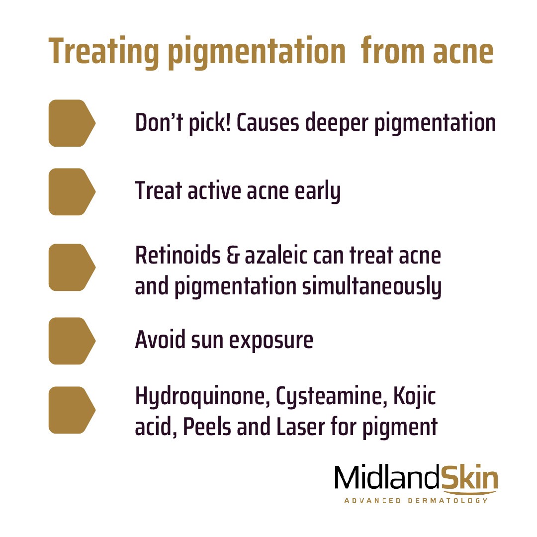 Acne Pigmentation Treatment in Birmingham by Dermatologists